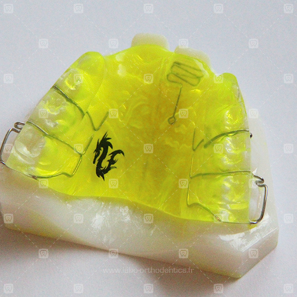 Orthodontie : la mobile | Laboratoire Orthodontic's